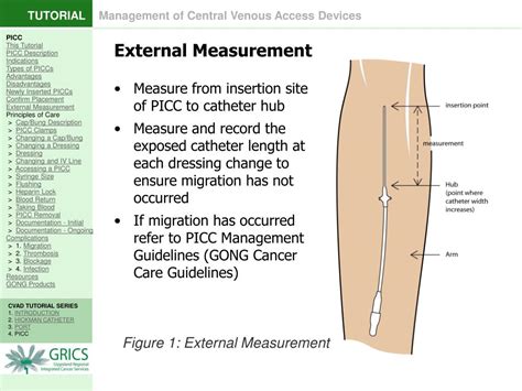 Picc Line Measurement Markings At Antionette Murphy Blog