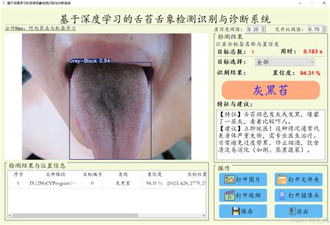 基于yolo11深度学习的舌苔舌象检测识别与诊断系统【python源码pyqt5界面数据集训练代码】yolov11 舌诊 Csdn博客