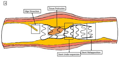 Current Applications And New Perspectives In Optical Coherence