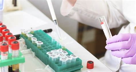 Unlocking The Potential Of Pichia Pastoris Expression System For Rhsa