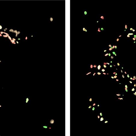 Thresholds Estimated With The Maximum Entropy Thresholding Method On A