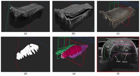 leg 3d us dataset lehrstuhl für informatikanwendungen in der medizin