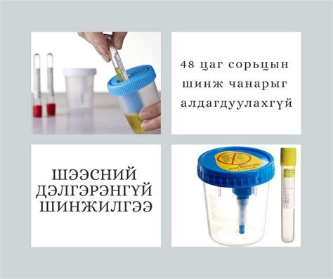 Шээсний ерөнхий шинжилгээ Urinalysis Бонавита лаборатори