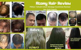 Atomy Hair Tonic Saengmodan