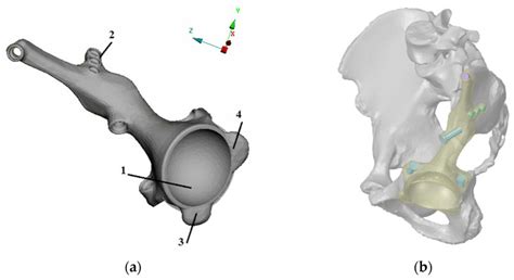 Finite Element Analysis Of Customized Acetabular Implant And Bone After Pelvic Tumour Resection