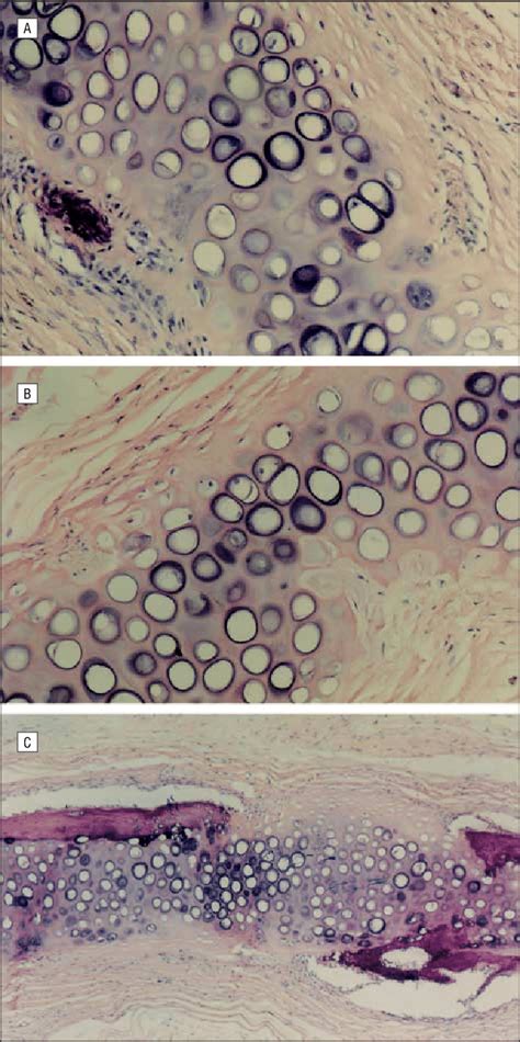 Slightly Crushed Grafts A Viable And Proliferating Chondrocytes Download Scientific Diagram