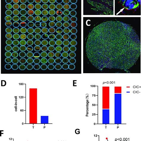 Detecting Homotypic Cics In A Tissue Microarray Tma Of Human Hcc A
