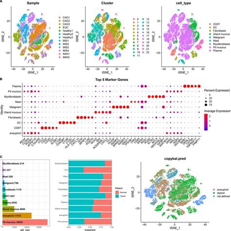 Hedgehog Pathway Activity In Scrna Seq Data Of Stomach Adenocarcinoma