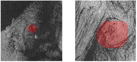 Eddydet A Deep Framework For Oceanic Eddy Detection In Synthetic Aperture Radar Images