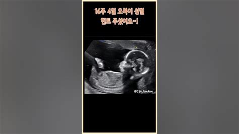 16주 오복이 성별이 성별따위 뭐든 좋아♥︎ 제발 건강하게만 태동이 뭔가요 저도 느끼고 싶어요~ 16주초음파 태아초음파 2차기형아검사 40대임신