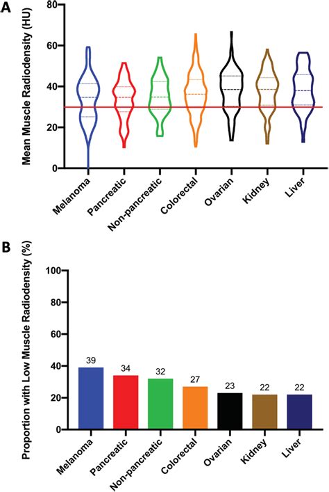 A Distribution Of Muscle Radiodensity Measurements In Patients With Download Scientific