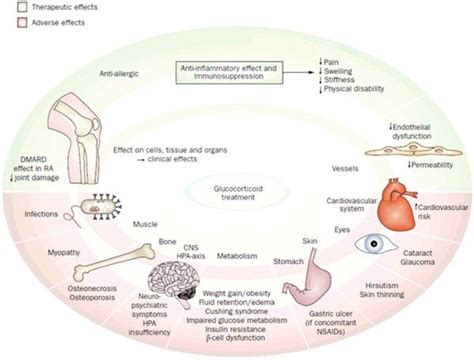 Steroid Induced Osteoporosis Symptoms Treatment Illnesshacker