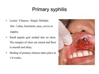 Syphilispptx
