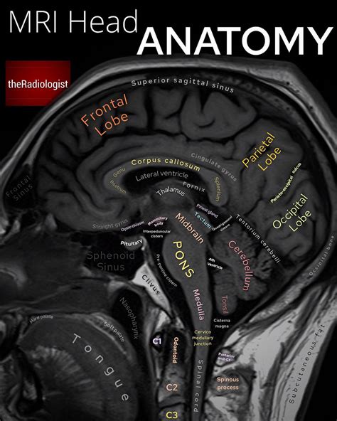 Anatomy Brain Mri Atlas At Leona Skelton Blog