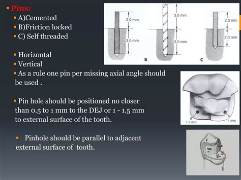 Class Ii Amalgam Pptx Dental Health Diseases And Conditions