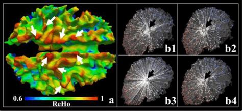 A Reho Regional Homogeneity Map Of Trace Maps On The Cortical