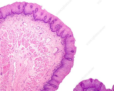 Human Oesophagus Light Micrograph Stock Image C0595039 Science