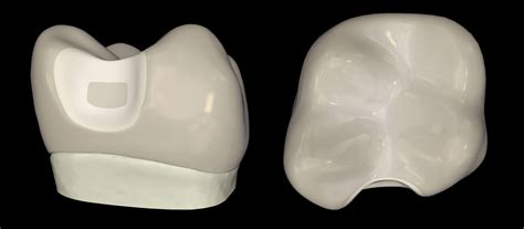 Biofit Part 1 Modern Class Ii Preparation Bioclear