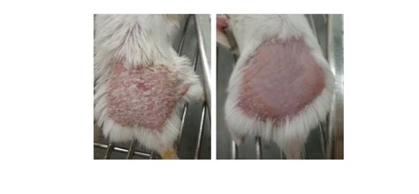 Imq Induced Psoriasis Model Psoriasis One Of The Most Common Yongping Chen Cro Expert In