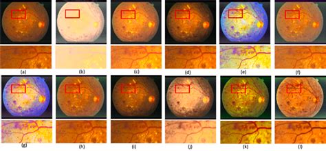 Subjective Evaluation Of Section Of Input And Improved Photos Of Download Scientific Diagram