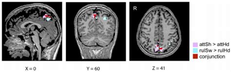 common sources of control for shifting spatial attention and switching