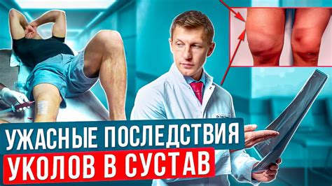 Для суставов уколы - инъекции для восстановления