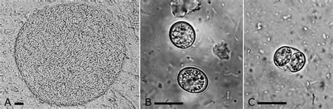 Toxoplasma Gondii Oocyst