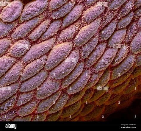 Colon Coloured Scanning Electron Micrograph Sem Of The Surface Of