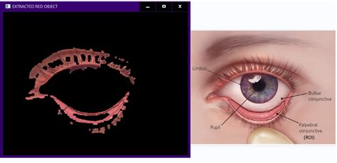 Python How Does Use MASK R CNN To Extract Exact Region In Image By OpenCV Stack Overflow