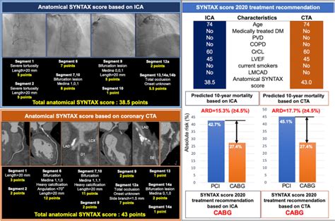 Treatment Recommendation Based On Syntax Score 2020 Derived From Coronary Computed Tomography