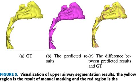figure 5 from upper airway segmentation based on the attention