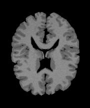 Github Sraycju Braintumorsegmentation Brain Tumor Segmentation Using Cnn
