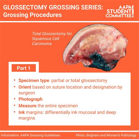 Aapa Students On Twitter This Week We Present Grossing Procedures