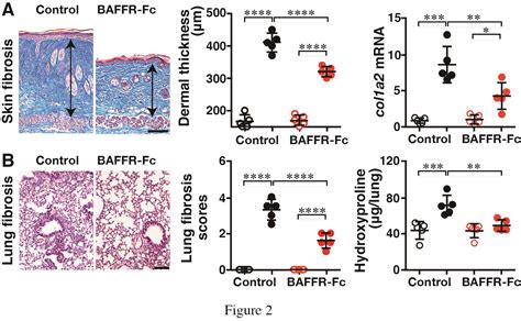 Baff Inhibition Attenuates Fibrosis In Bleomycin Induced Scleroderma