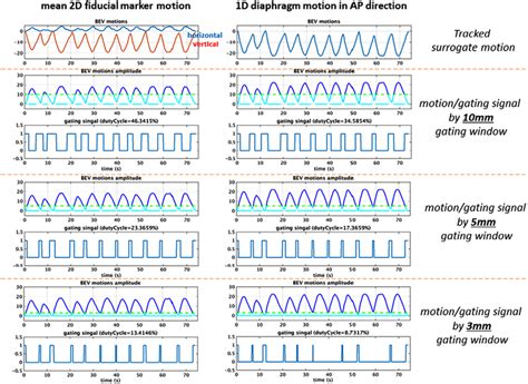 Online Tracked Surrogate Motion And The Derived Gating Signals For Download Scientific Diagram