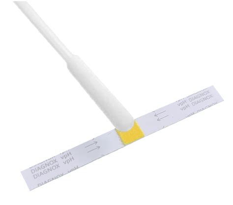 How To Carry Out An At Home Yeast Infection Test