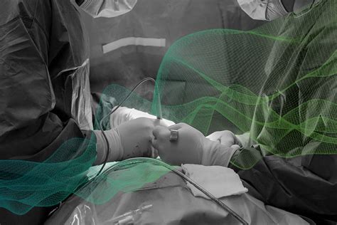 Benefits Of Nir Fluorescence In Laparoscopic Cholecystectomy