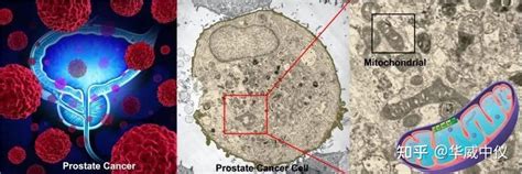 Nature子刊 高级别前列腺癌中的 Oxphos 重塑涉及 Mtdna 突变和琥珀酸氧化增加 知乎