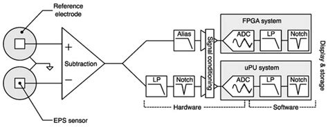fpga implementation of ecg signal processing for use in a neonatal