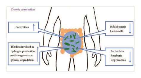 Alterations Of Gut Microbiota In Chronic Constipation The Gut