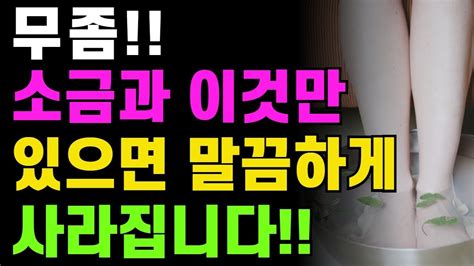 무좀 소금과 이것만 있으면 말끔하게 사라집니다 무좀 없애는법 확인하세요 Youtube
