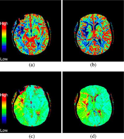 figure 3 from lesion area detection using source image correlation