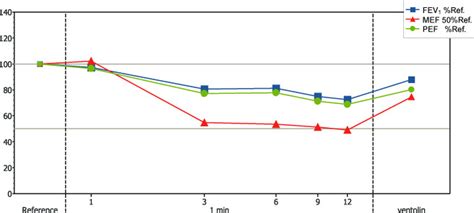 Exercise Challenge Test Download Scientific Diagram