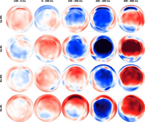 Topographies Of The Difference Waves For All Four Conditions In Time