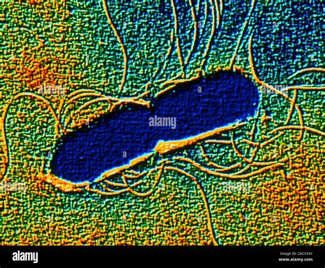 Food Poisoning Bacterium Coloured Scanning Electron Micrograph Of The Gram Positive Anaerobic