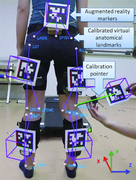 Calibration Of Anatomical Points Using The Calibration Pointer The Download Scientific Diagram