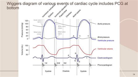 Phonocardiogram Pptx Heart And Cardiovascular Diseases Diseases And Conditions