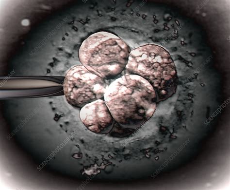 Ivf Embryo Light Micrograph Stock Image C055 1887 Science Photo Library