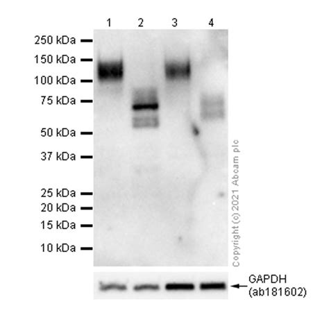 Anti Interferon Alpha Beta Receptor 1 Antibody [epr6244] Ab124764 Abcam