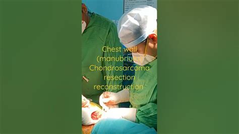 Chondrosarcoma Cancer Chest Sternum Youtube